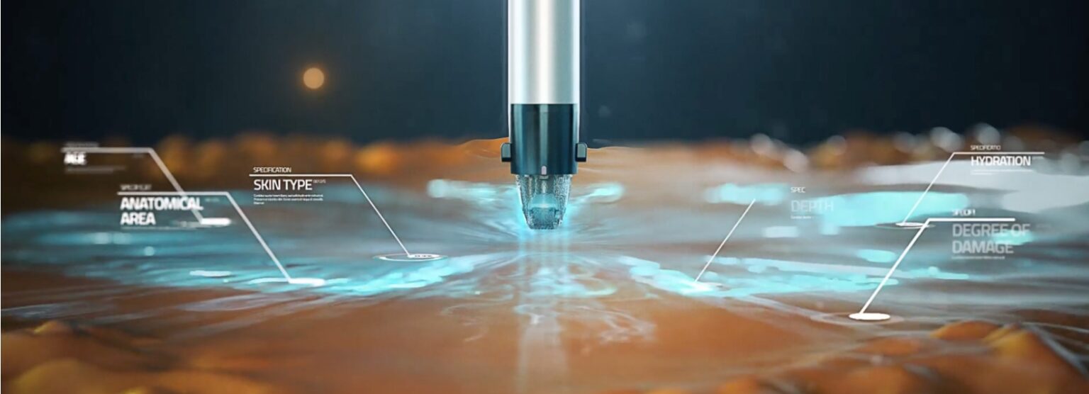 Genius® Radiofrequency Microneedling | Swiss Derma Clinic